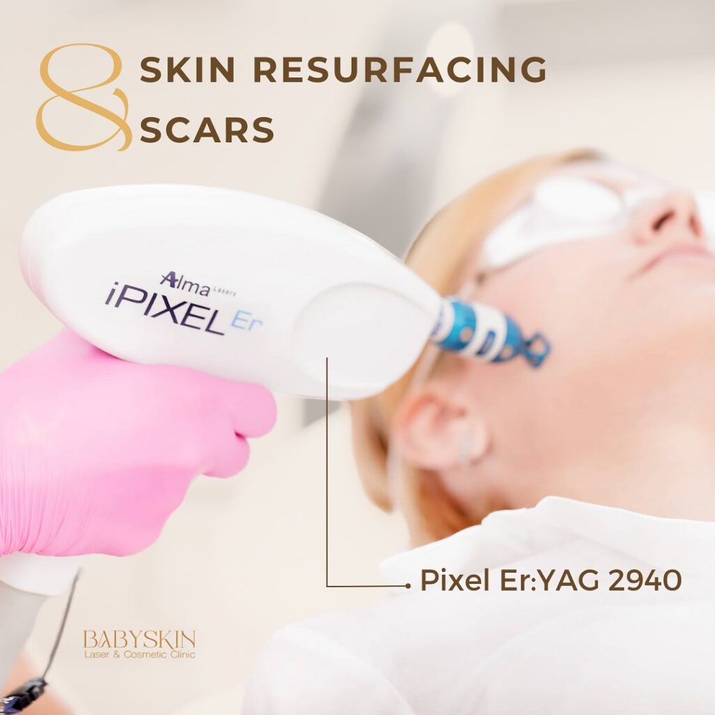 BABYSKIN Laser & Cosmetic Clinic | Laser Resurfacing